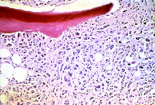 WSU-SOM | CTU MD Lab | CASE 2