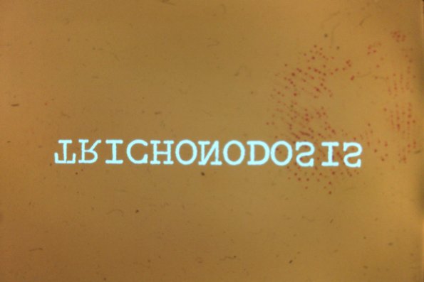 Trichonodosis (2) | Trichos | Comprehensive Dermatology Photo Atlas ...